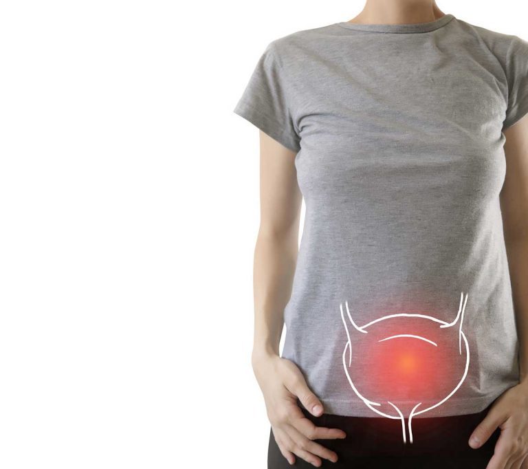 The Top 5 Female Bladder Problems - Women's Health Arizona
